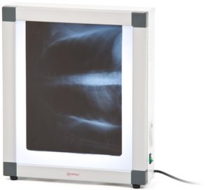 Rating of the best negatoscopes in 2025