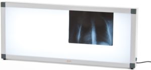 Rating of the best negatoscopes in 2025